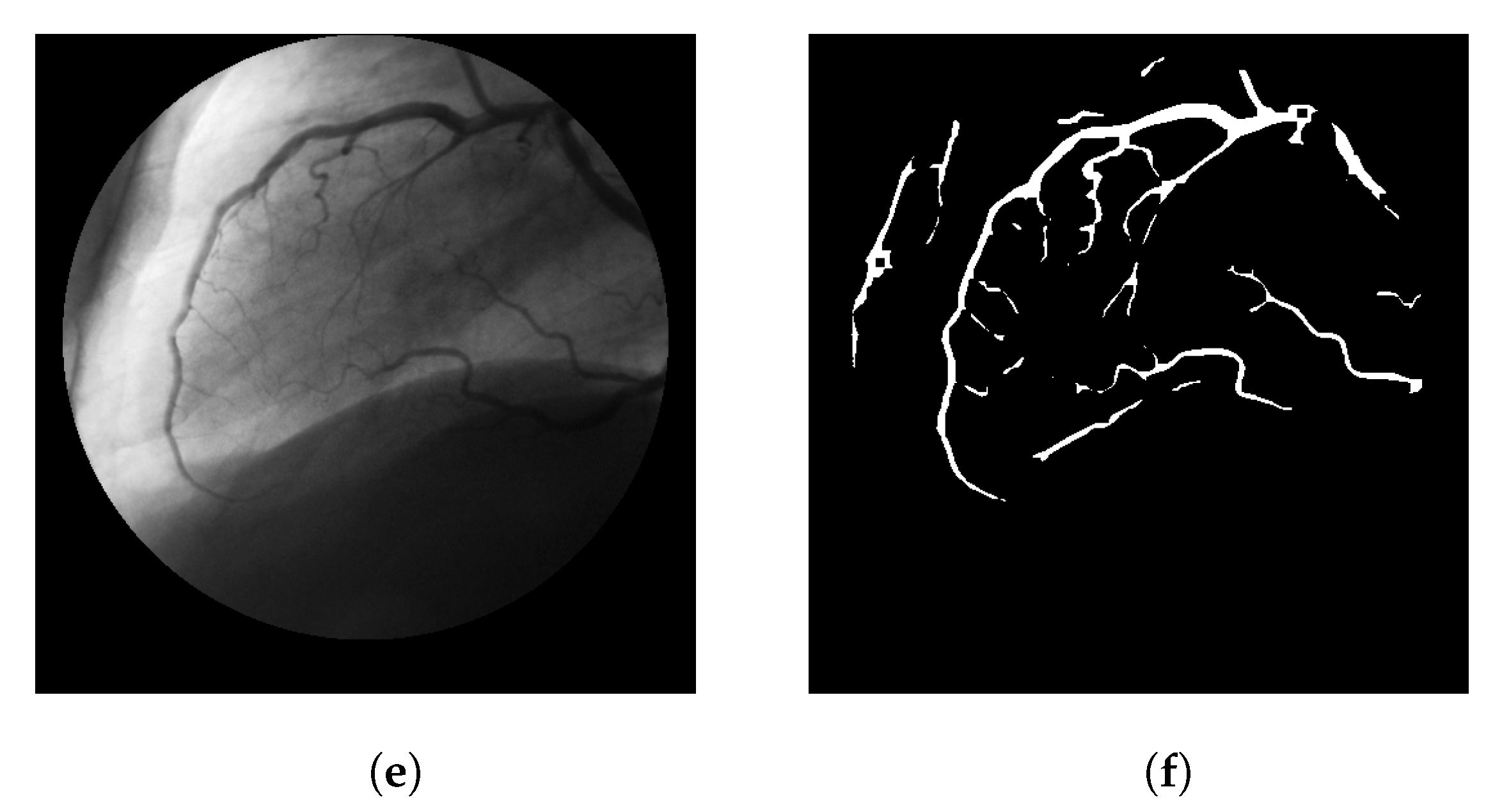 Local-Sensitive Connectivity Filter (LS-CF): A Post-Processing ...