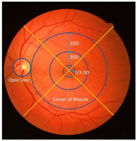 Efficient and Robust Method to Detect the Location of Macular Center ...