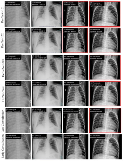 Disease Recognition in X-ray Images with Doctor Consultation-Inspired Model