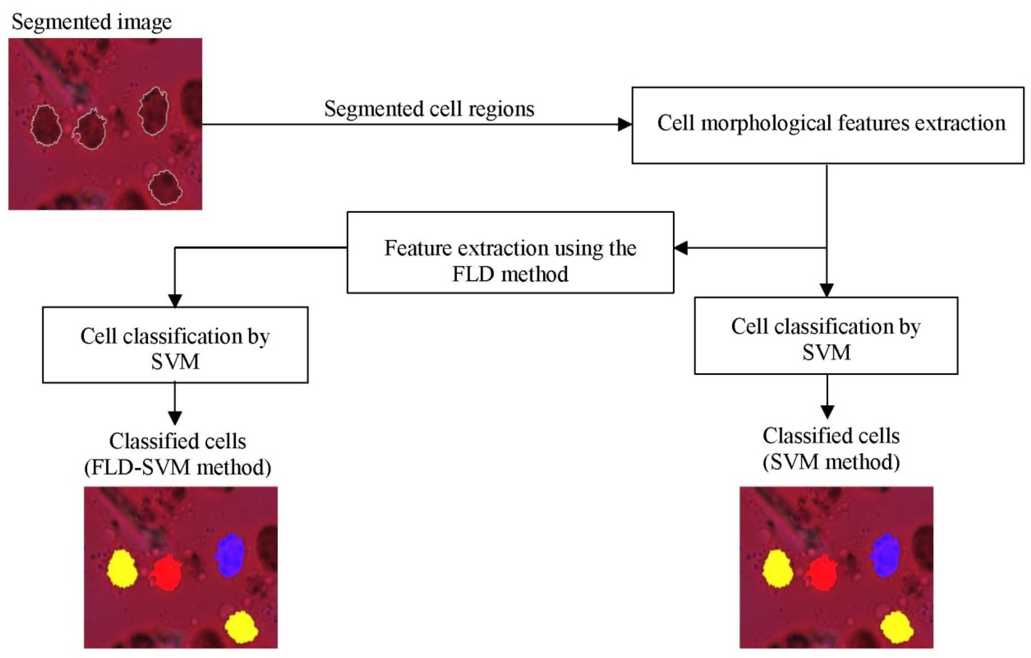 J. Imaging | Free Full-Text | Fuzzy Model for the Automatic Recognition of Human Dendritic Cells