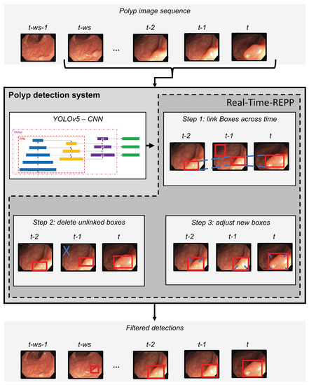 J Imaging Free Full Text A Real Time Polyp Detection System With Clinical Application In