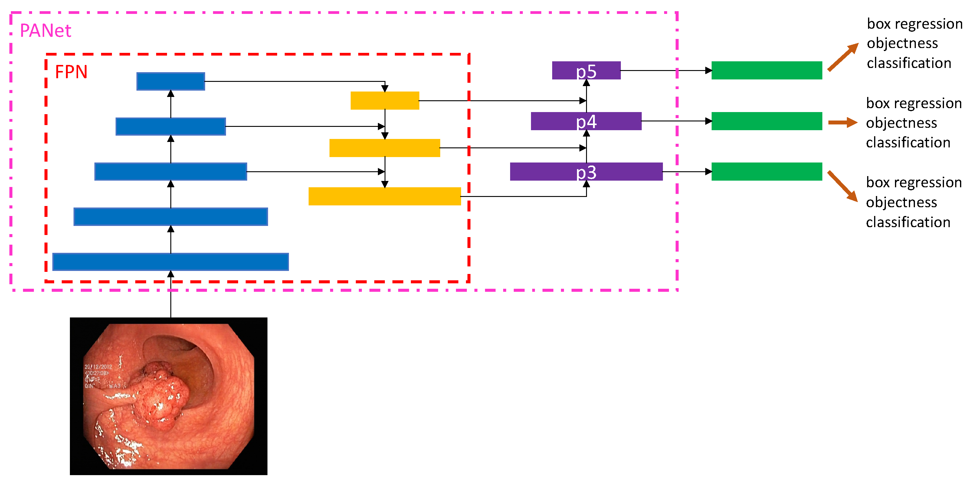 A Real-Time Polyp-Detection System with Clinical Application in Colonoscopy Using Deep ...