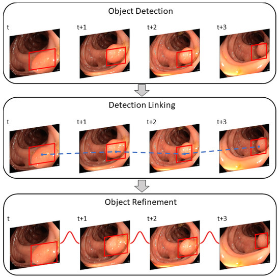 A Real-Time Polyp-Detection System with Clinical Application in ...