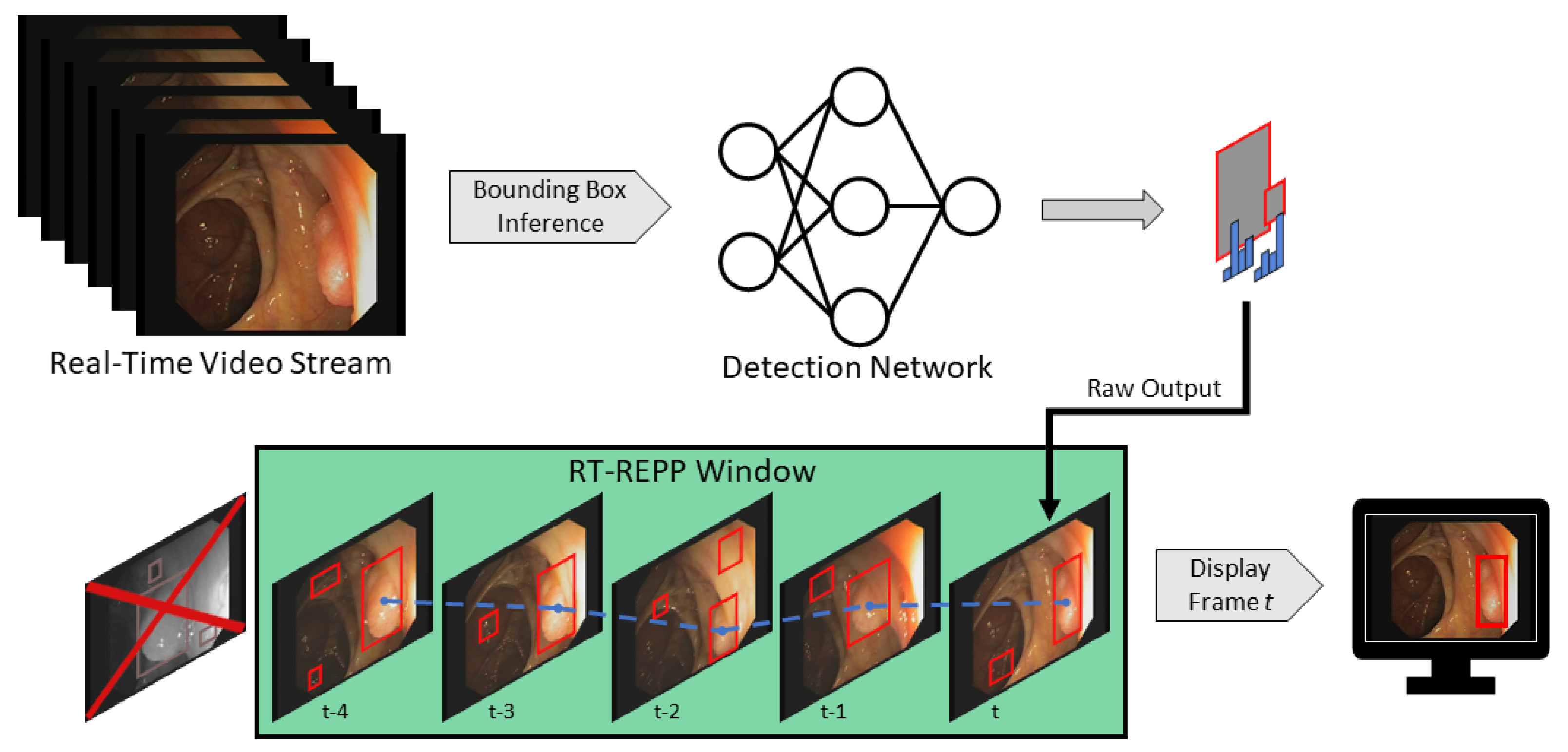 A Real-Time Polyp-Detection System with Clinical Application in Colonoscopy Using Deep ...