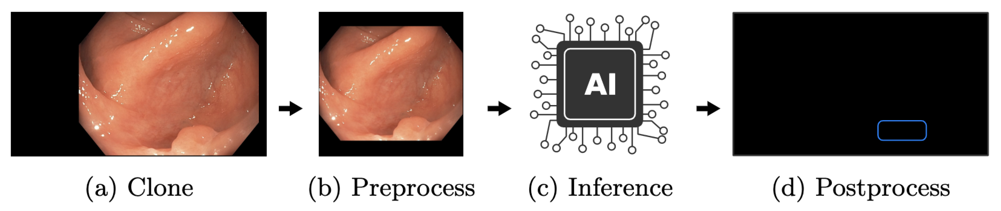 A Real-Time Polyp-Detection System with Clinical Application in Colonoscopy Using Deep ...