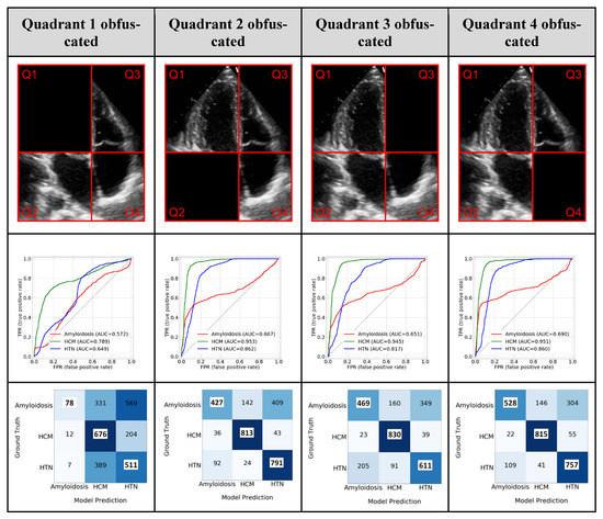 J. Imaging | Free Full-Text | Developing an Echocardiography-Based ...