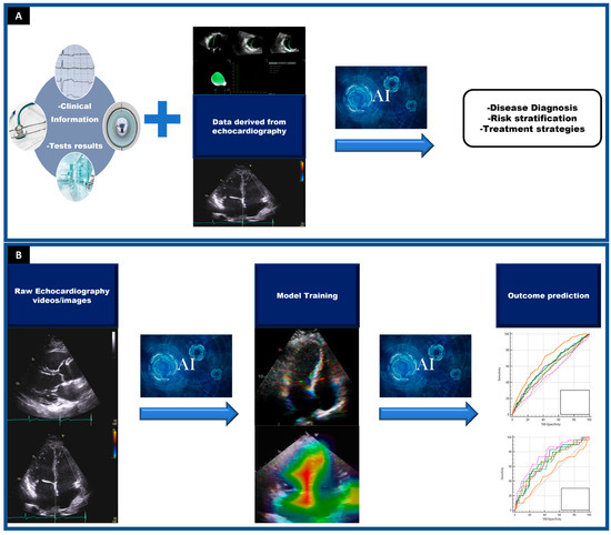 The Role of Artificial Intelligence in Echocardiography