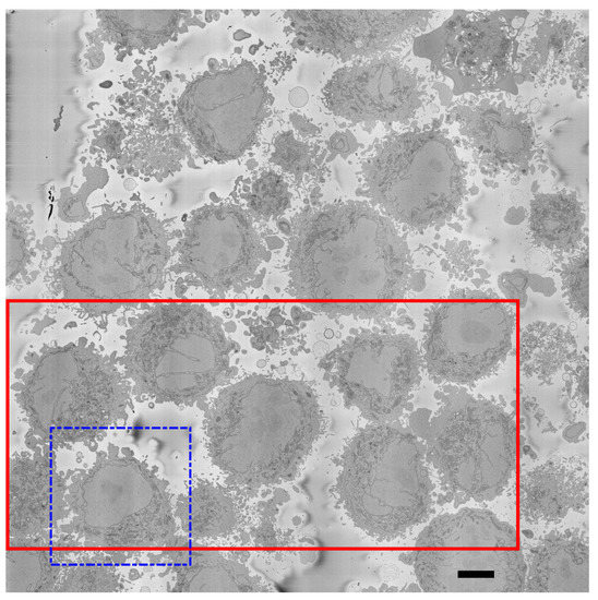 Impact of Training Data, Ground Truth and Shape Variability in the Deep ...