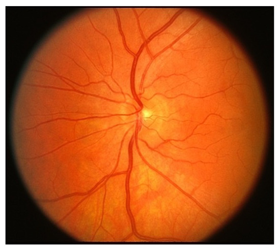 J. Imaging | Free Full-Text | Retinal Disease Detection Using Deep ...