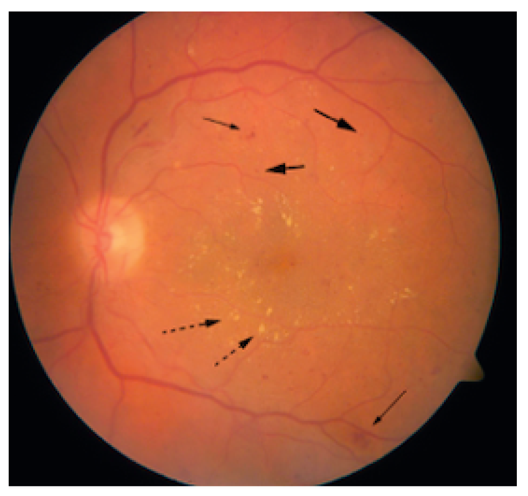 J. Imaging | Free Full-Text | Retinal Disease Detection Using Deep ...