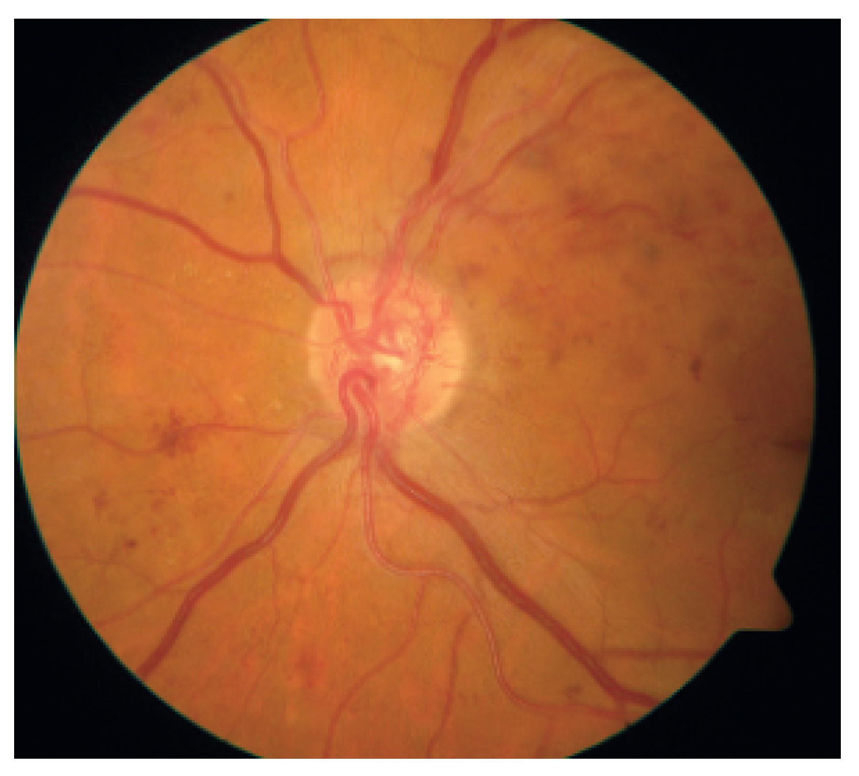 J. Imaging | Free Full-Text | Retinal Disease Detection Using Deep ...