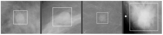 Mammography Datasets for Neural Networks—Survey