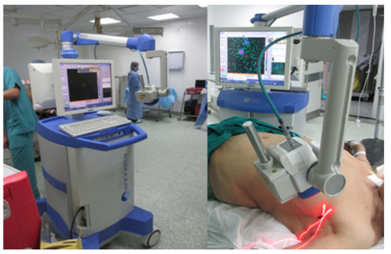 J. Imaging | Free Full-Text | Intraoperative Gamma Cameras: A Review of ...