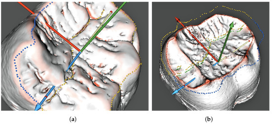 Measuring Dental Enamel Thickness: Morphological and Functional ...