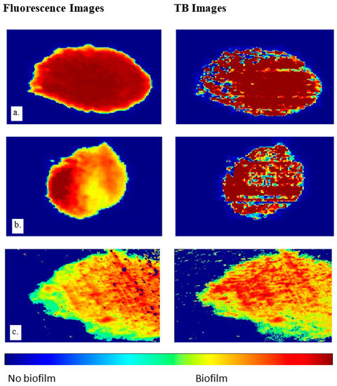 Selective Optical Imaging for Detection of Bacterial Biofilms in Tissues