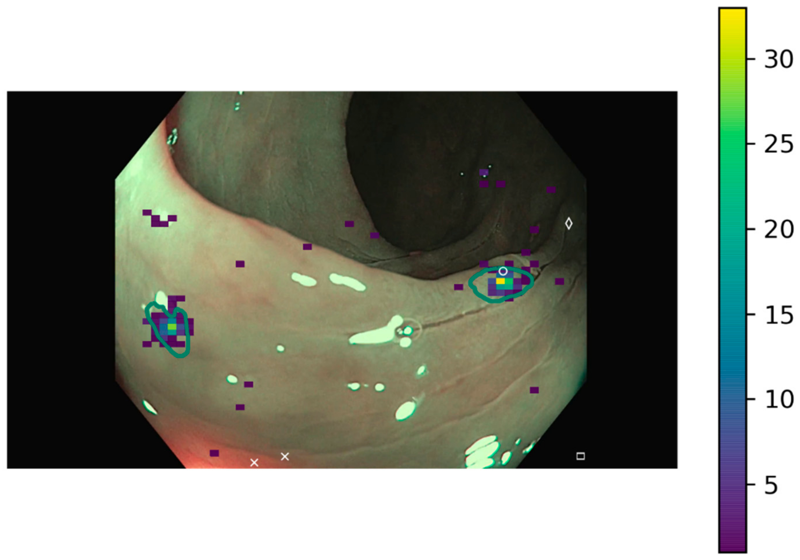 Clinical Validation Benchmark Dataset and Expert Performance Baseline for Colorectal Polyp ...