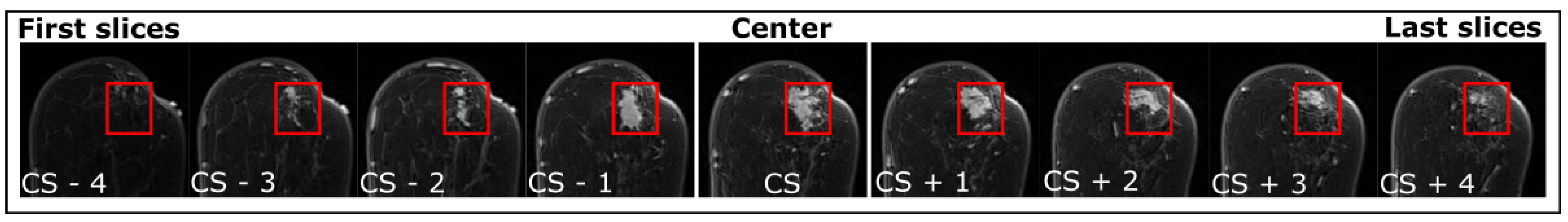 An Innovative Faster R-CNN-Based Framework for Breast Cancer Detection ...