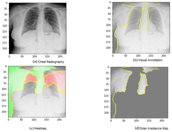 Explainable Artificial Intelligence (XAI) for Deep Learning Based ...