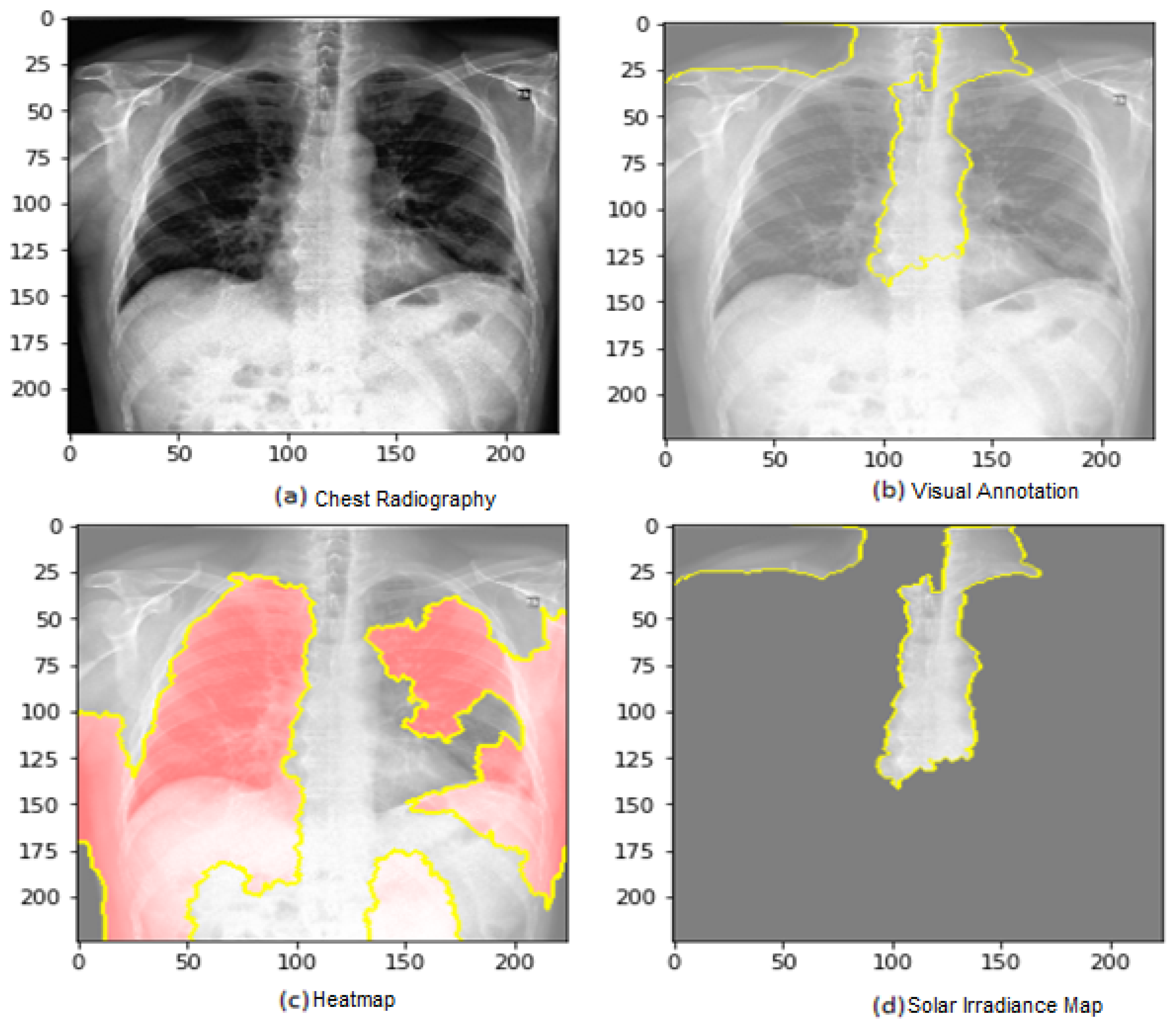 Explainable Artificial Intelligence (XAI) for Deep Learning Based Medical Imaging Classification