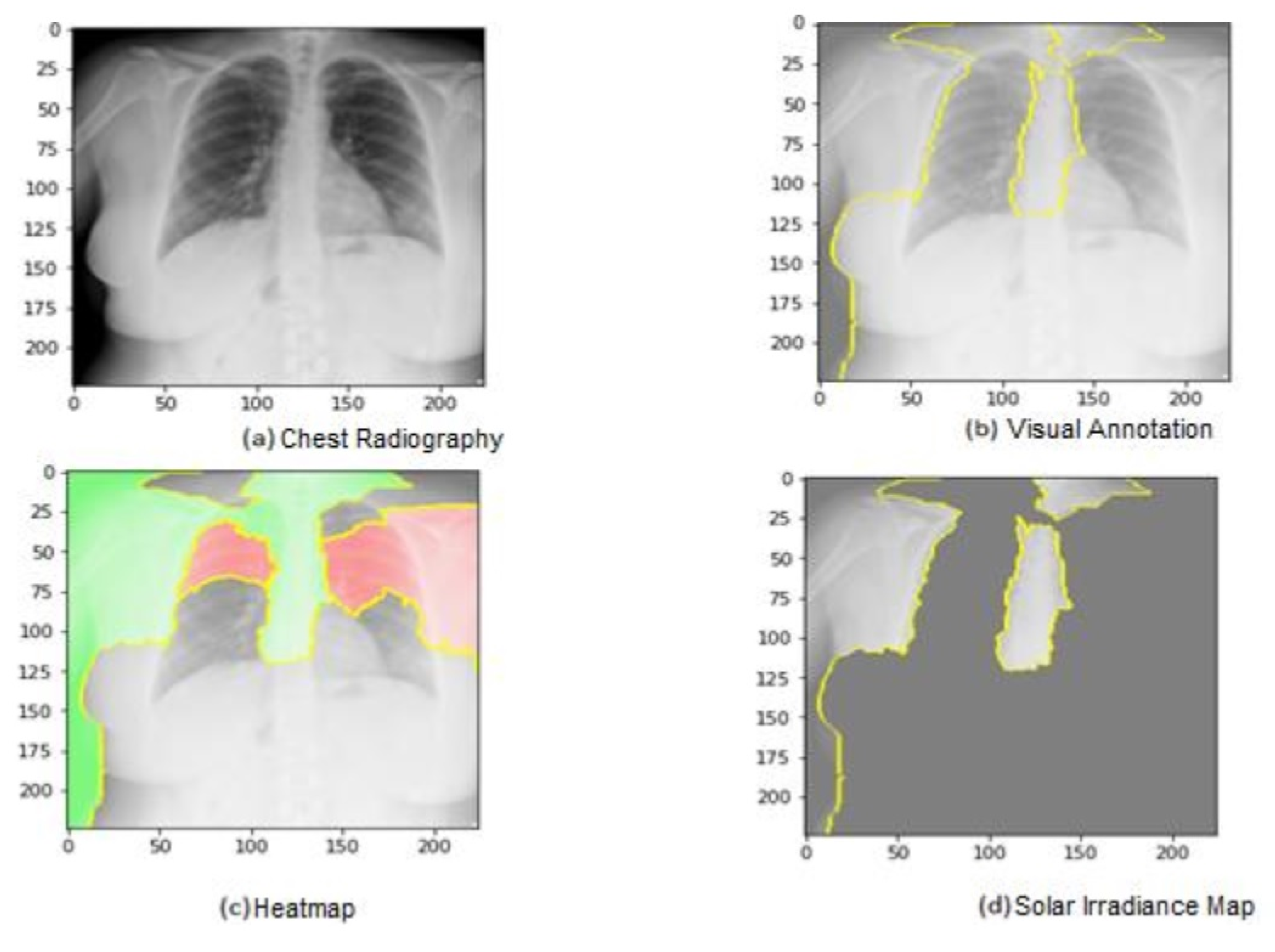 Explainable Artificial Intelligence (XAI) for Deep Learning Based ...