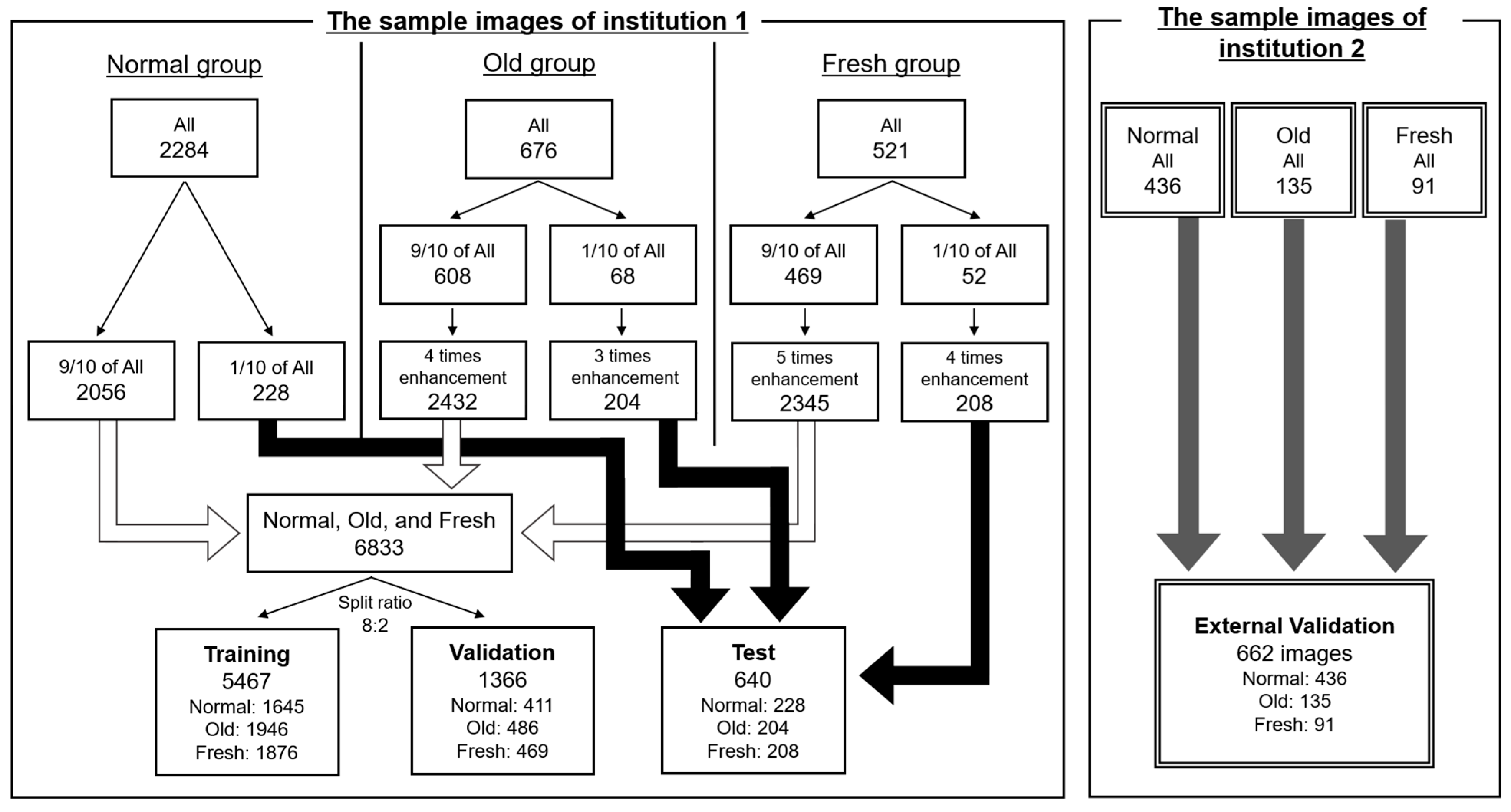 A Deep Learning-Based Model for Classifying Osteoporotic Lumbar Vertebral Fractures on ...