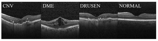 J. Imaging | Free Full-Text | Multi-Fundus Diseases Classification Using Retinal Optical ...