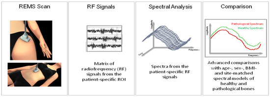 Radiofrequency Echographic Multispectrometry (REMS): A New Option in the Assessment Bone Status ...