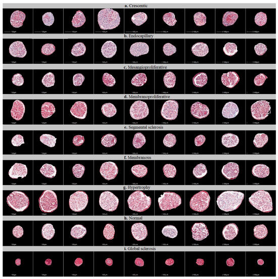 A Spatially Guided Machine-Learning Method to Classify and Quantify ...