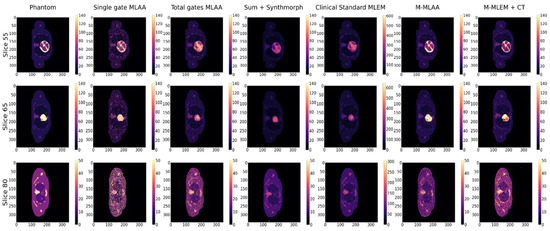 J. Imaging | Free Full-Text | Spatio-Temporal Positron Emission ...