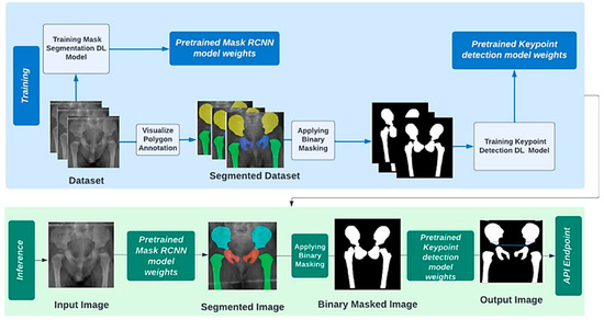 Assessing Acetabular Index Angle in Infants: A Deep Learning-Based Novel Approach