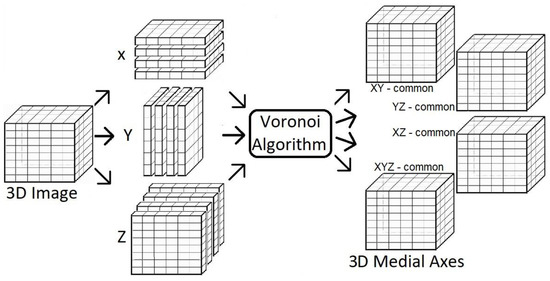 Automated Coronary Artery Tracking with a Voronoi-Based 3D Centerline Extraction Algorithm