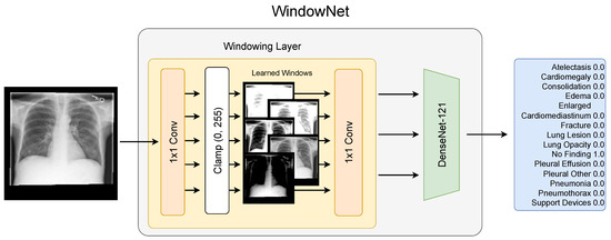 WindowNet: Learnable Windows for Chest X-ray Classification