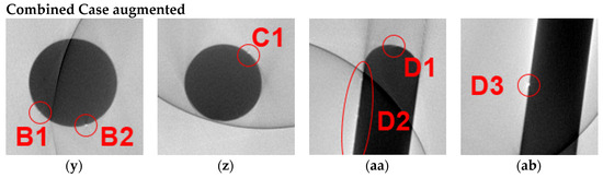 Simulation-Assisted Augmentation of Missing Wedge and Region-of ...
