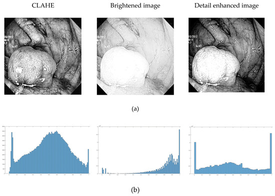 Endoscopic Image Enhancement: Wavelet Transform and Guided Filter ...
