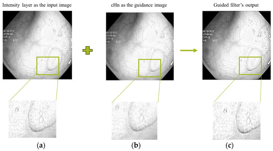 Endoscopic Image Enhancement: Wavelet Transform and Guided Filter Decomposition-Based Fusion ...
