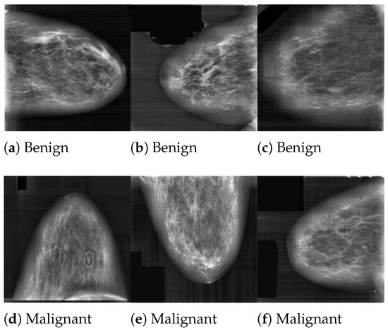J. Imaging | Free Full-Text | A CNN Hyperparameters Optimization Based ...