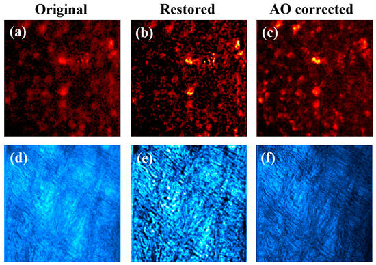 Spherical Aberration and Scattering Compensation in Microscopy Images ...