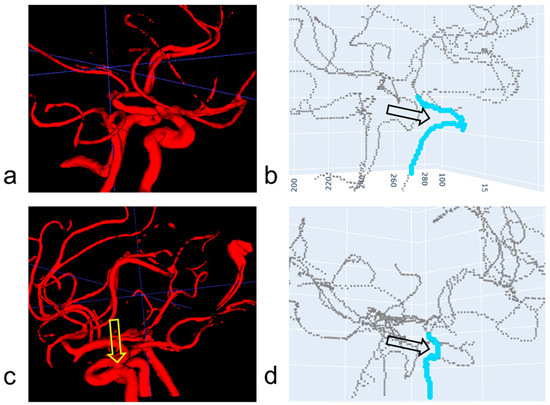 An Improved Path-Finding Method for the Tracking of Centerlines of ...