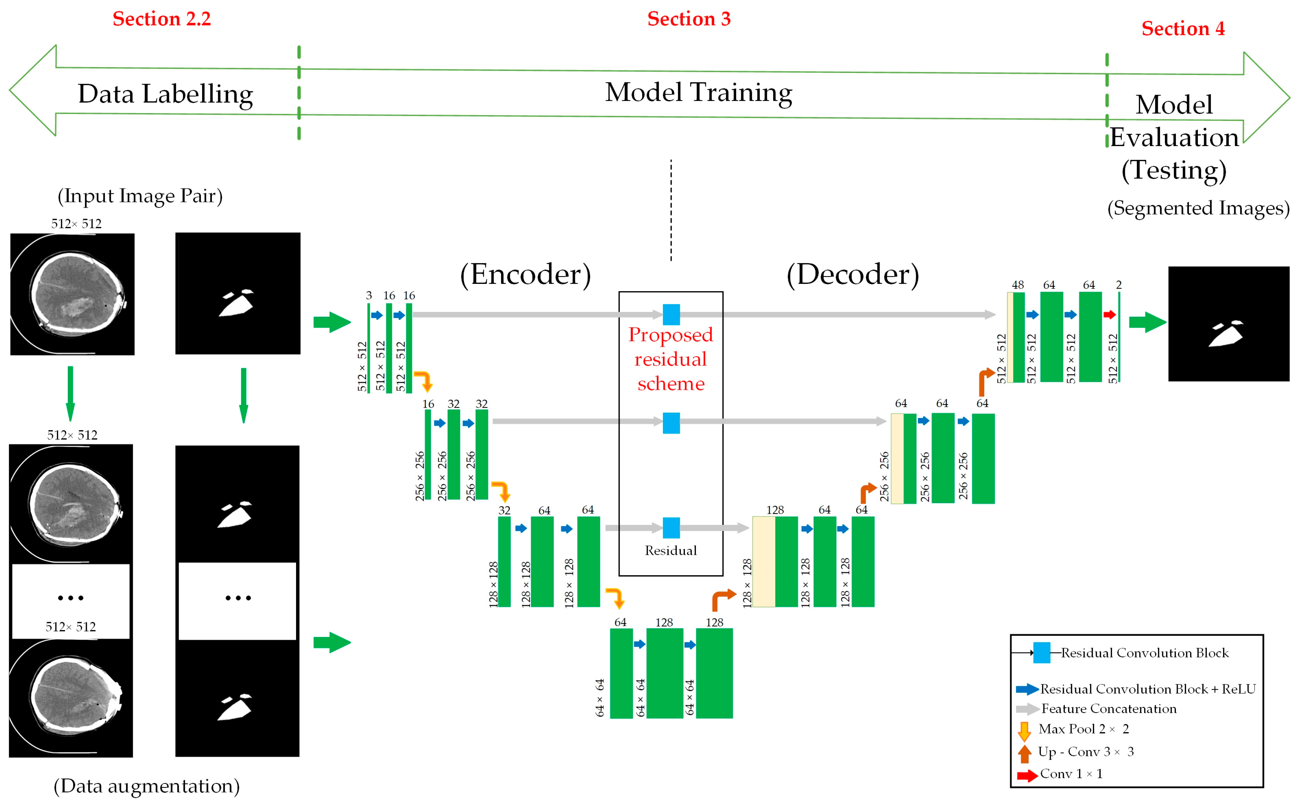 An Efficient CNN-Based Method for Intracranial Hemorrhage Segmentation ...