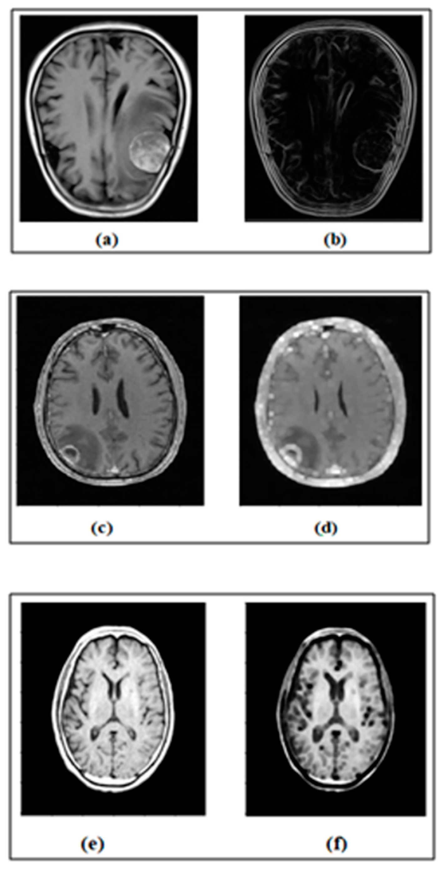 J. Imaging | Free Full-Text | Measuring Effectiveness of Metamorphic ...