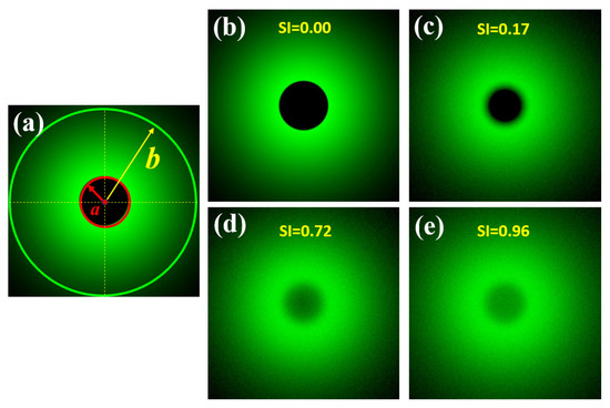 Subjective Straylight Index: A Visual Test for Retinal Contrast ...