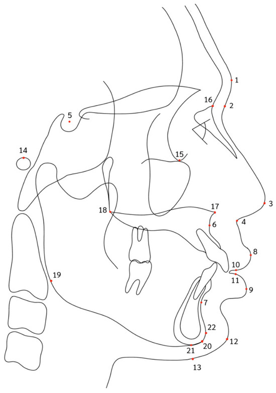 Accuracy of Digital Imaging Software to Predict Soft Tissue Changes ...