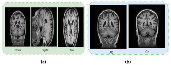 Residual-Based Multi-Stage Deep Learning Framework for Computer-Aided ...