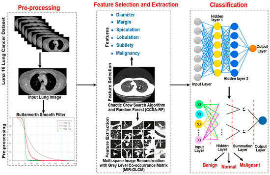 J. Imaging | Free Full-Text | Automated Lung Cancer Diagnosis Applying Butterworth Filtering, Bi ...