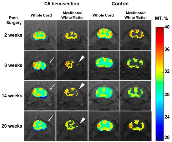 Longitudinal Imaging of Injured Spinal Cord Myelin and White Matter ...