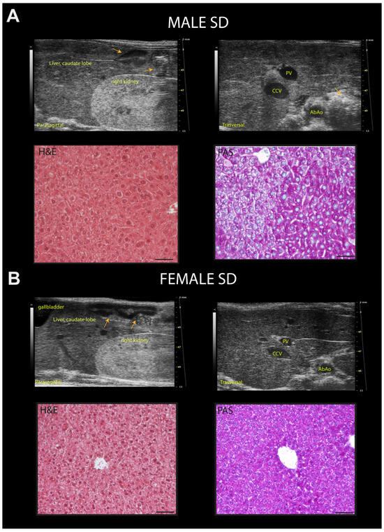 Integrated Ultrasound Characterization of the Diet-Induced Obesity (DIO ...