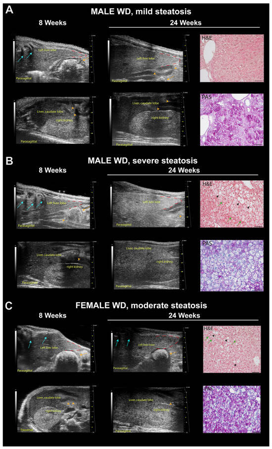 Integrated Ultrasound Characterization of the Diet-Induced Obesity (DIO ...