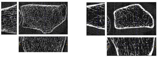 Three-Dimensional Bone-Image Synthesis with Generative Adversarial Networks