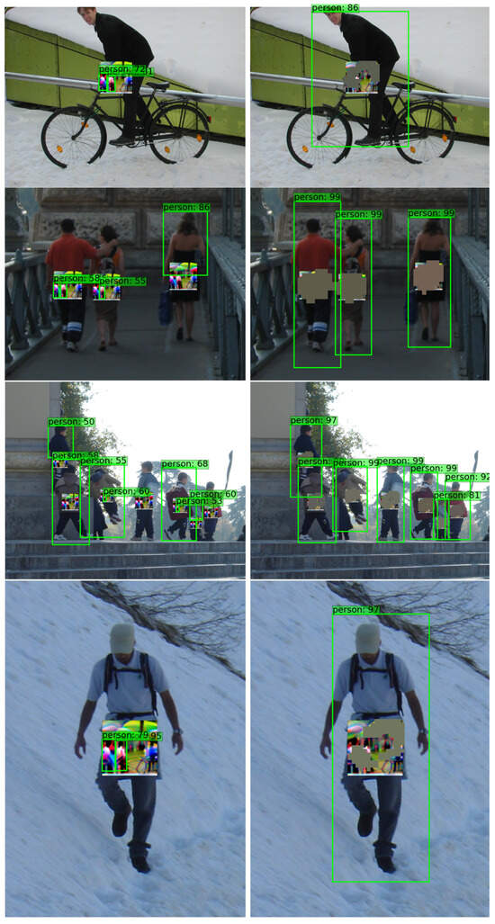 Increasing Neural-Based Pedestrian Detectors’ Robustness to Adversarial Patch Attacks Using ...