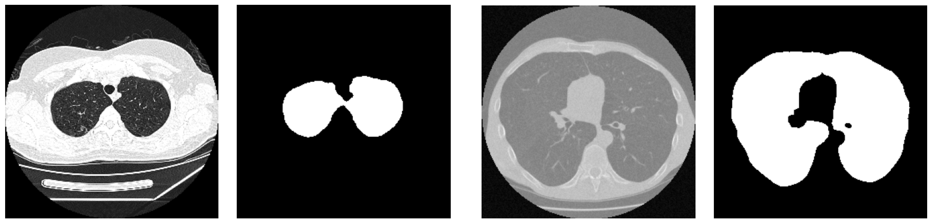 Enhancing U-Net Segmentation Accuracy Through Comprehensive Data Preprocessing